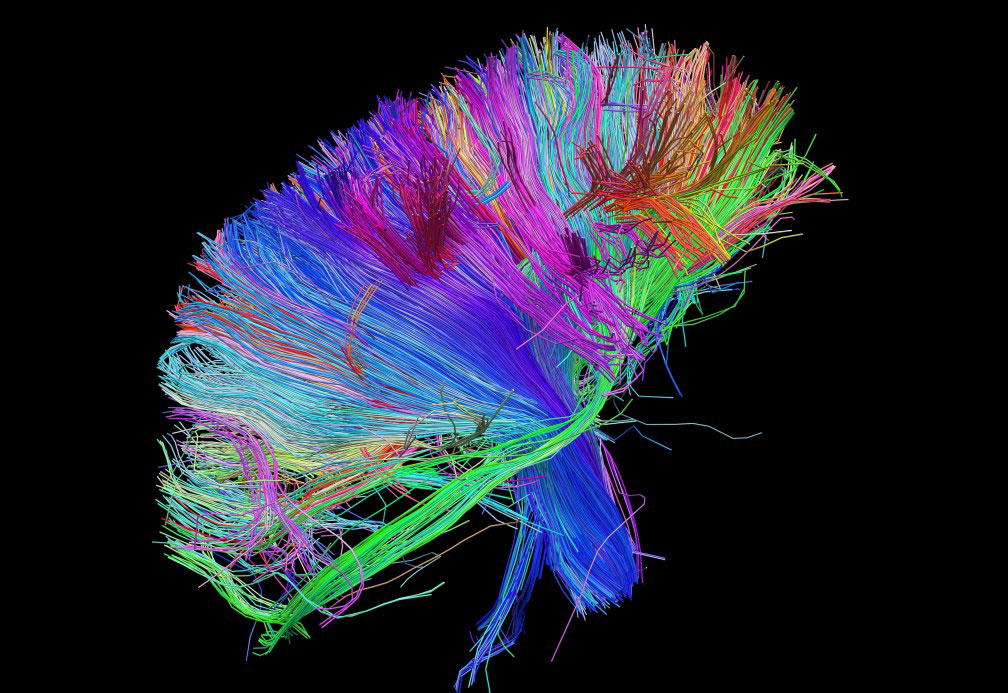 Necktop. – Danny Gregory